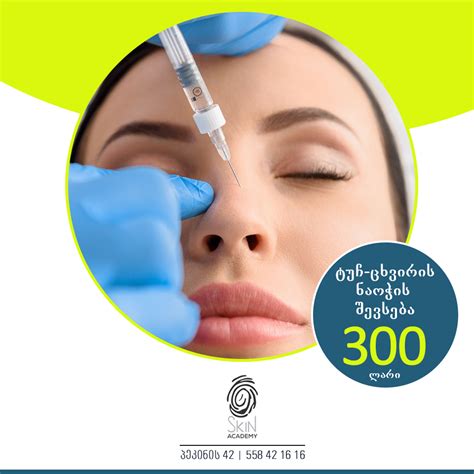 Skin Academy • სქინ აკადემია 👩‍🔬 ტუჩ ცხვირის ნაოჭის შევსება 3⃣0⃣0⃣ ლარი 🎊 ქალაქში საუკეთესო