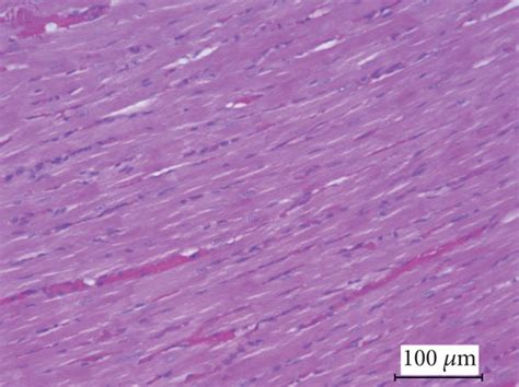 Representative Histological Slides Of Rats Hearts In The C1 A C2