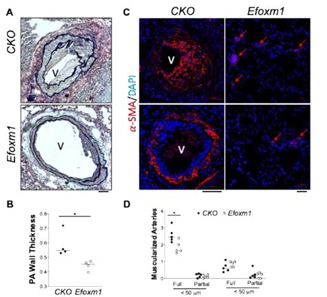 Foxm1 Deletion In Ecs Attenuated Pulmonary Vascular Remodeling In Egln1