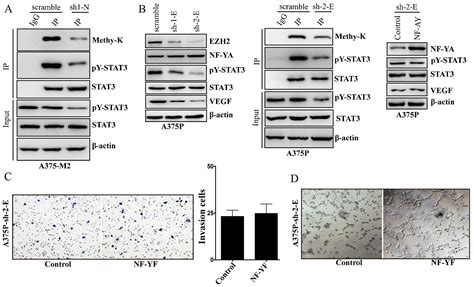 Nf Ya Promotes Invasion And Angiogenesis By Upregulating Ezh2 Stat3