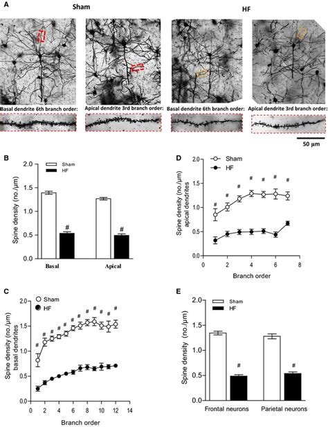 HF Induces Morphological Changes And A Reduction In Number Of Dendritic