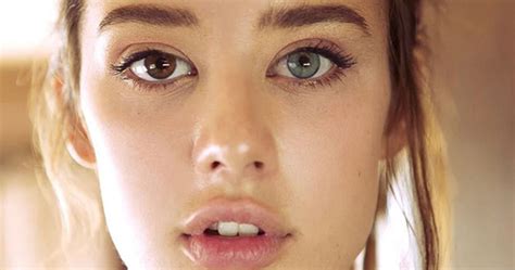 The Beautiful Medical Condition Called Heterochromia Euzy