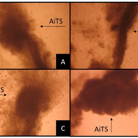 Isolation Of Adhesion Independent Tumor Spheres Aits From Cell Download Scientific Diagram