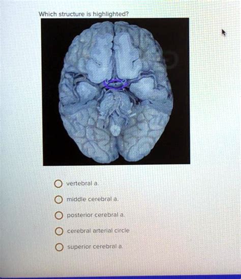 SOLVED Which Structure Is Highlighted Vertebral Middle Cerebral