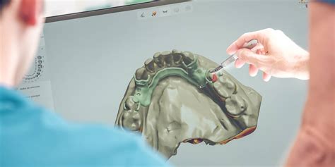 Understanding The Four Types Of Jaw Misalignment Oral Surgeon Boulder Co
