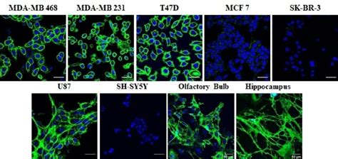 Cd44 Expression Levels For Different Cancer And Neural Cell Lines