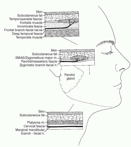 Facelift Plastic Surgery Key