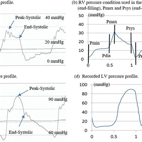 Recorded Patient Specific Pressure Profiles And Pressure Conditions