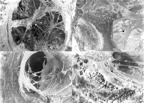The Scanning Electron Micrographs Of Human Autologous Mesenchymal
