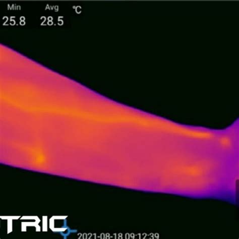 What Is Thermal Sensitivity