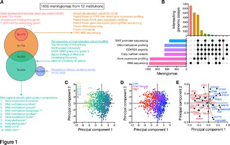 Figure 1 From Targeted Gene Expression Profiling Predicts Meningioma