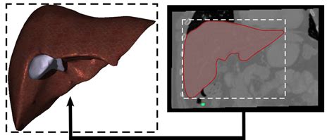 Models Are Generated By Complex Segmentation Procedures From Anatomical