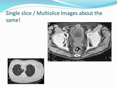 Ppt Multi Slice Ct Powerpoint Presentation Free Download Id 5573730