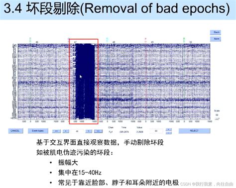 脑电信号处理与特征提取——4脑电信号的预处理及数据分析要点（彭微微） Csdn博客