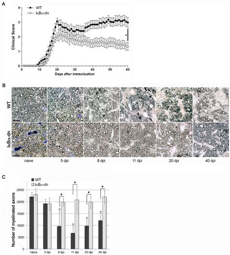 Histological Analysis And Quantification Of Myelinated Axons In The