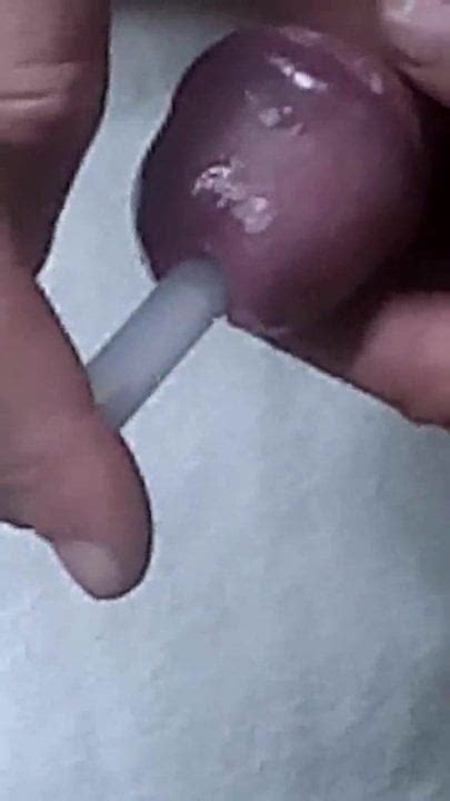 Insertion Bulb And Glue Stick In To Urethra Indian Gay Desi Porn