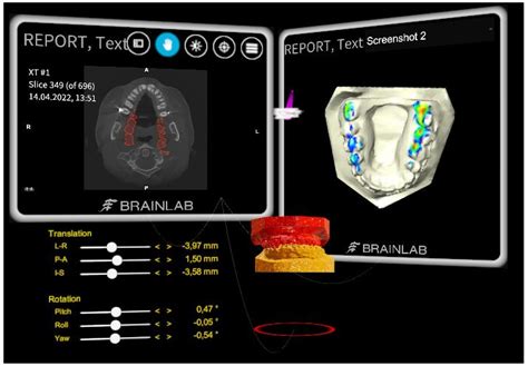 Occlusion Data Analysis At David Laramie Blog