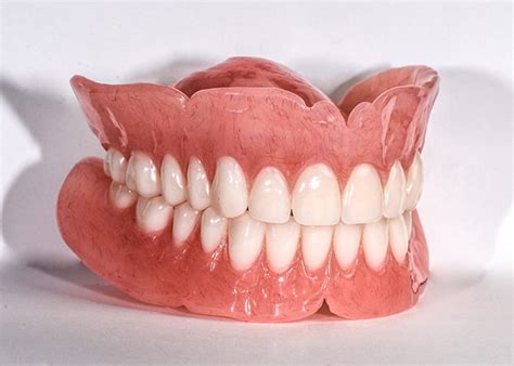 Denture Types A Comprehensive Guide To Dental Prosthetics