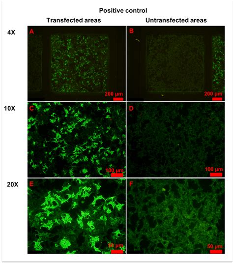 Human Serum Anti Aquaporin 4 Immunoglobulin G Detection By Cell Based Assay