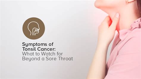 Tonsil Cancer Early Signs