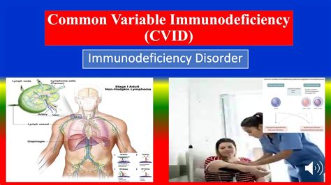 Common Variable Immunodeficiency Cvid Definition Types