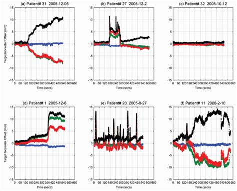 Use Of Implanted Fiducial Markers In Image Guided Radiation Therapy Radiology Key