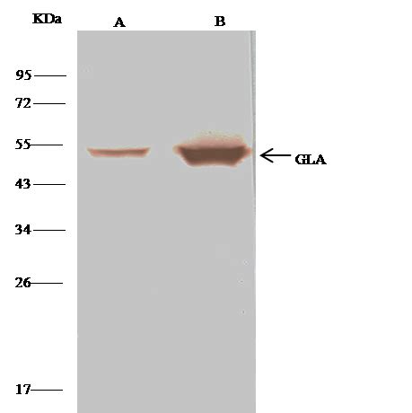 Anti Glaalpha Galactosidase A Antibody Rabbit Pab 12078 T52 Sino