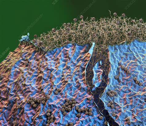 Slime Mould Sem Stock Image C057 4172 Science Photo Library