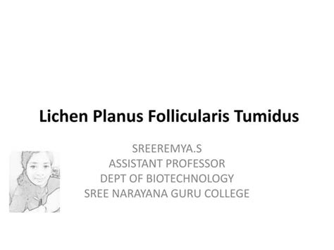 Lichen Planus Pptx