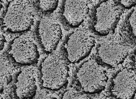 4 Fundamental Concepts Of Enamel And Dentin Adhesion Pocket Dentistry
