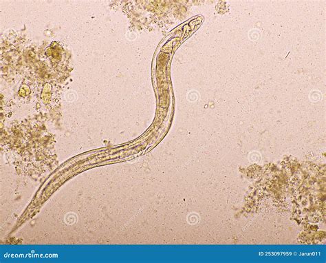 Strongyloides Stercoralis Male Vs Female