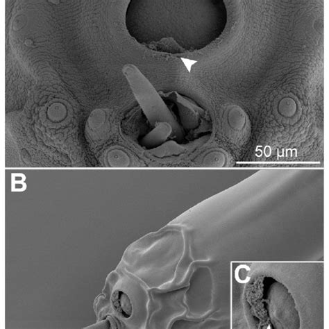 Strongyluris Oscari Travassos 1923 Scanning Electron Micrographs Of