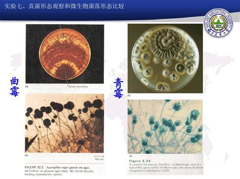 实验七 真菌形态观察和微生物菌落形态比较 Word文档在线阅读与下载 无忧文档
