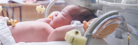 Hyperbilirubinemia Cause Of Jaundice In Newborns And Adults