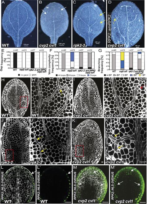 Silencing Of RPK2 Expression Rescues The Branching Defects Of Cvp2