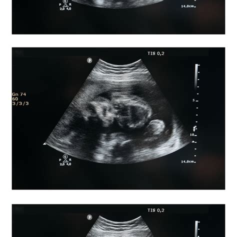 Fake Ultrasound Ultrasound Pictures Prank Gifts Good Jokes Digital