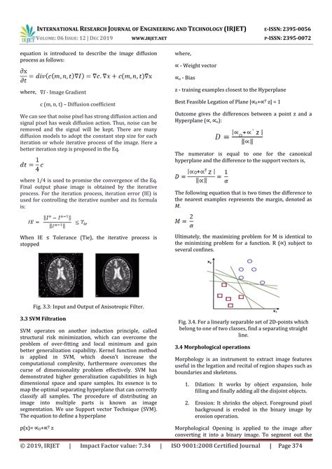 Irjet Brain Tumor Detection Using Image Processing And Matlab