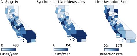 County‐level Variation In The Utilization Of Liver Resection In