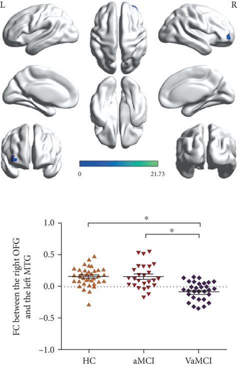 The Results Of One Way Ancova And Post Hoc Analysis Indicated