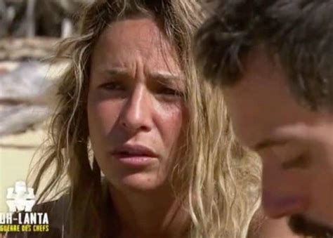Cindy Koh Lanta 20 totalement défigurée après quun chien lui ai