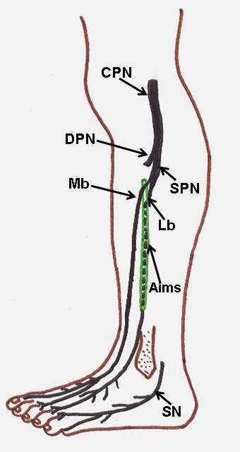 Superficial Peroneal Nerve Block