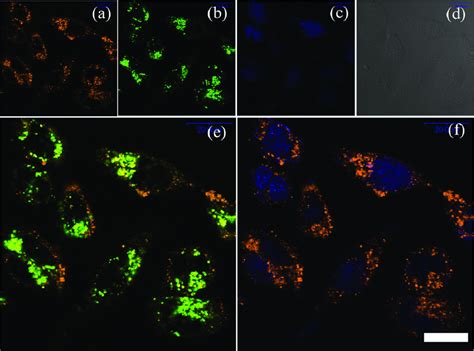Intracellular Distribution Of Qd Aptamer Angiogenin Conjugates In Huvec