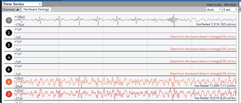 Impedance Question Noisy Eeg Signal Openbci Forum