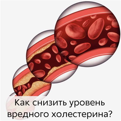 Как снизить уровень холестерина? | Кристина Шереметьева | Дзен