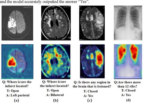 Figure From Masked Vision And Language Pre Training With Unimodal And Multimodal Contrastive