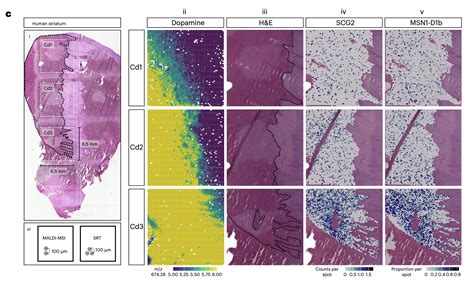 Bridging The Gap Between Gene Expression And Metabolism A New