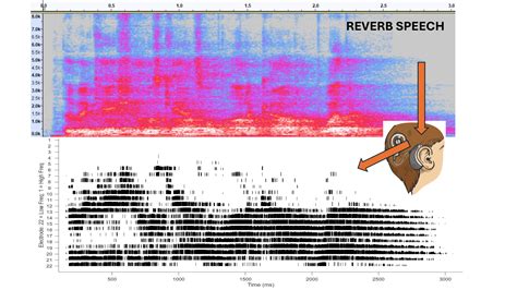 Why Do Cochlear Implant Users Struggle To Understand Speech In Echoey Spaces
