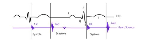 [solved] Activity 3 Correlation Of Heart Sounds And Electrical Events Of Course Hero