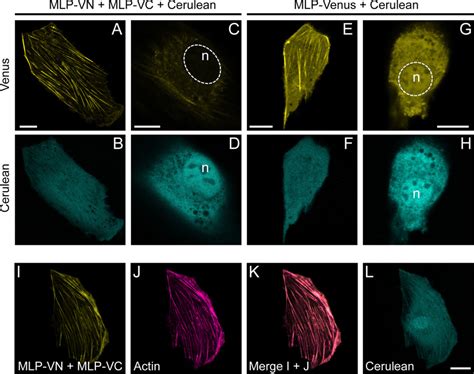 MLP BiFC Complexes Localize Along The Actin Cytoskeleton A And C