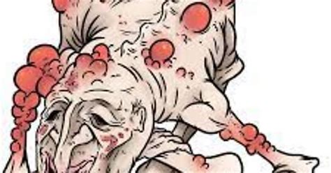 Pimple Popper Album On Imgur